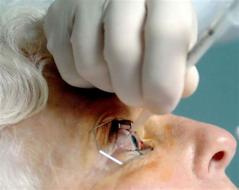 Build A Safer Intravitreal Injection Protocol Ophthalmology Advisor