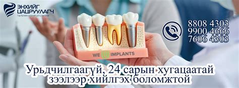 ДоДо Шүд эрүү нүүрний эмнэлэг 🇲🇳БАЯРЫН ӨДРҮҮДЭД АЖИЛЛАХ ЦАГЫН ХУВААРЬ Өдөр бүр 09 00 00 00