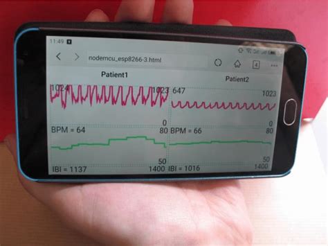Output Of The Two Sensors From Two Different Patients Download Scientific Diagram