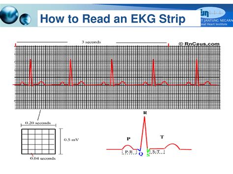 Cvt Mohd Farid Basic Ecg Part Ii Rate Rhythm Axis