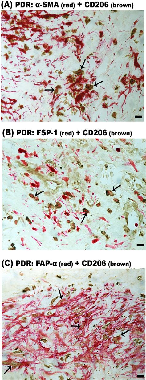 Figure 8 From Macrophage Myofibroblast Transition Contributes To