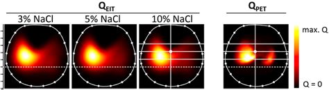 The Three Images On The Left Show The Relative Perfusion Measured By
