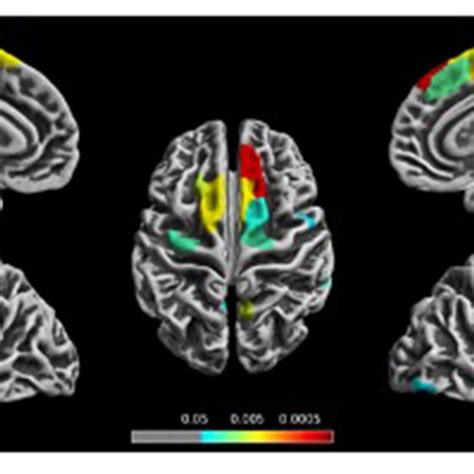 Comparison Of Cognitive Performance Of Matrics Consensus Cognitive Download Scientific Diagram