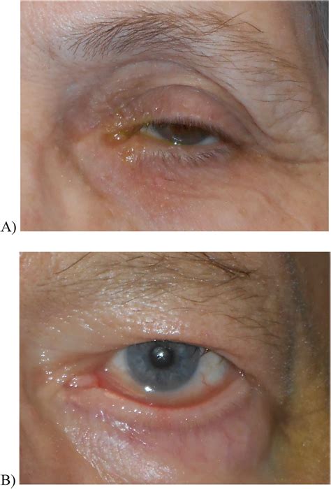 These Photographs Demonstrate The Representative Features Present In Download Scientific