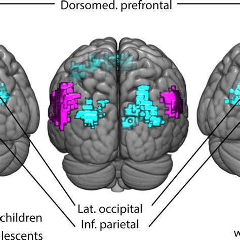 Age‐related Differences In Mean Memory Performance For The New Paired Download Scientific