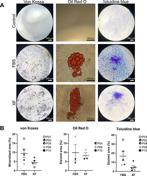 Multilineage Differentiation Of Mds Mscs Mds Mscs Expanded Using Xf Or Download Scientific