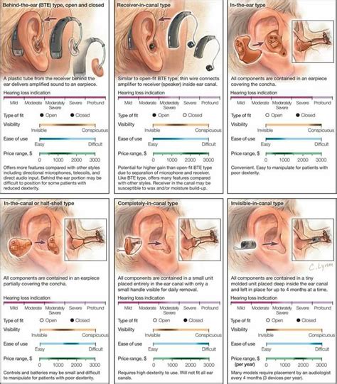 Parts Of A Bte Hearing Aid At Irene Rayburn Blog