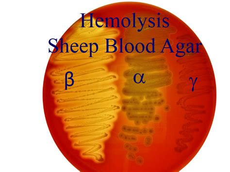 Blood Agar Alpha Beta Gamma