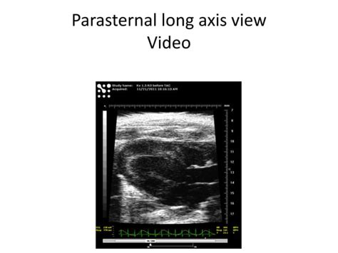 Mouse Echocardiography Echo Guided Intraventricular And Intramyocardial Injection Ppt