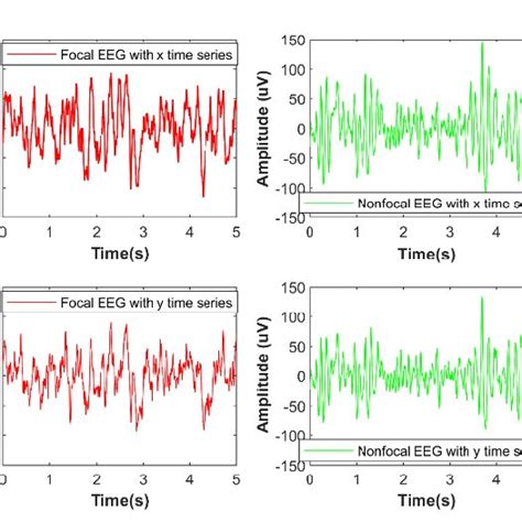 5 S Of Sample Focal Non Focal Eeg Records Of Xy Pairs Download Scientific Diagram