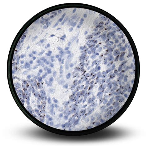 Acd Bio
