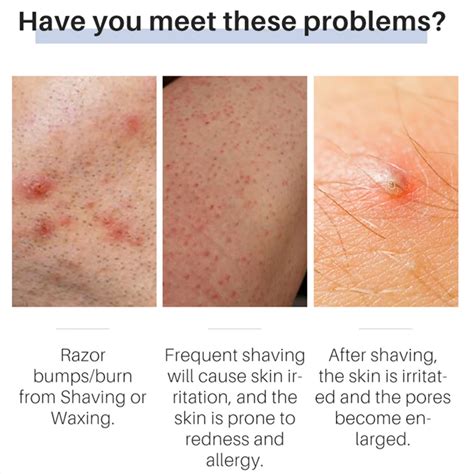 Male Pubic Razor Burn