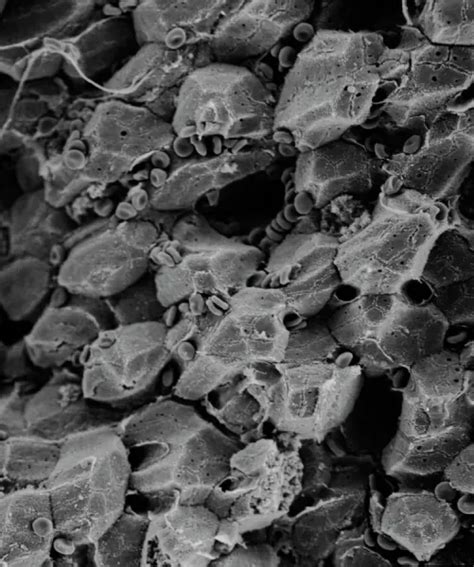 Liver Scanning Electron Microscope Sem Our Beautiful Wall Art And Photo Ts Include Framed
