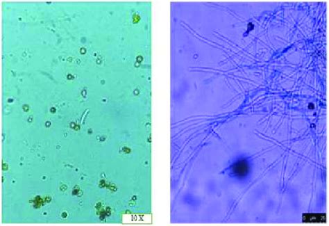 Characteristics Of False Smut Spores And Mycelium Under Microscope Download Scientific Diagram