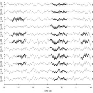 Multichannel Sleep Spindle Detection Using Sparse Low Rank Optimization Request PDF