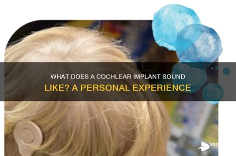What Does A Cochlear Implant Sound Like A Personal Experience Soundcy
