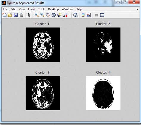Clustering By Spatial Fcm Download Scientific Diagram