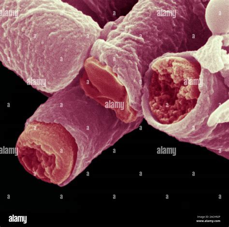 Anthrax Spores Coloured Scanning Electron Micrograph Sem Of Bacillus
