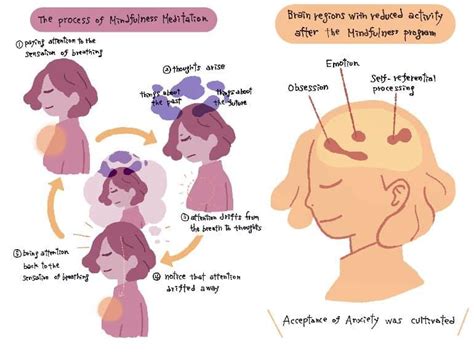 Kevin Khoo On Linkedin Neural Correlates Of A Mindfulness Based Intervention In Anorexia Nervosa