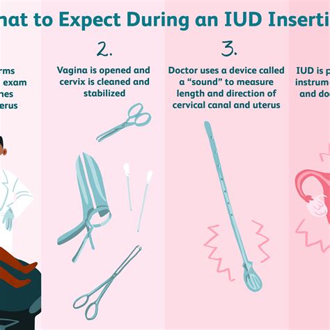 Iud Insertion