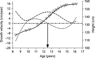 The Figure Demonstrates The Calculation Of Growth Velocity And Age At