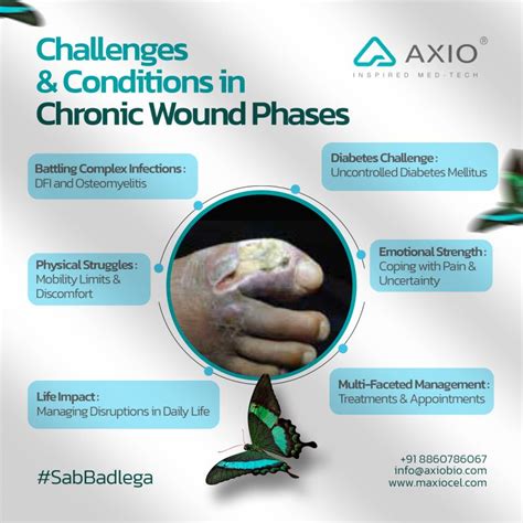 somya gupta posted on linkedin