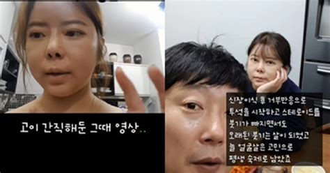 ‘이수근♥ 박지연 “스테로이드 부작용으로 문페이스 필러 다 흘러내려”