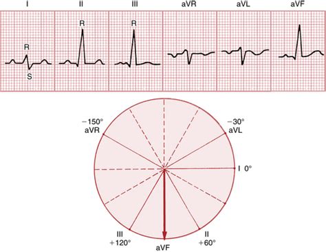 Horizontal Axis Of Ecg Graph