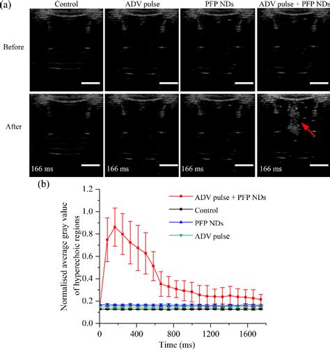 Figure From Enhanced And Spatially Controllable Neuronal Activity Induced By Transcranial