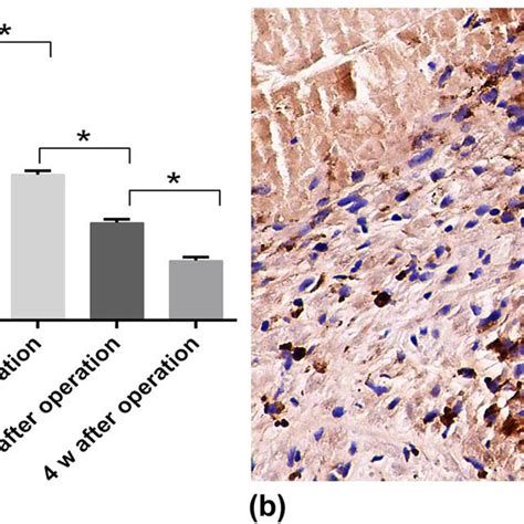 Myocardial Contrast Echocardiography After Injecting The Microbubble Download Scientific