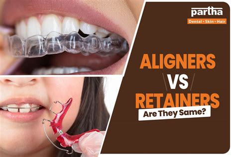 Aligners Vs Retainers Differences And Benefits Explained