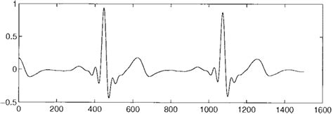 a original ecg and b high pass filtered ecg download scientific