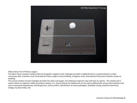 Catalase Test Pptx