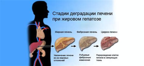 Гепатоз | Meddoc