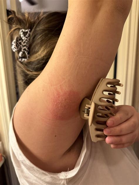 Dexcom G7 Reaction R Dexcom