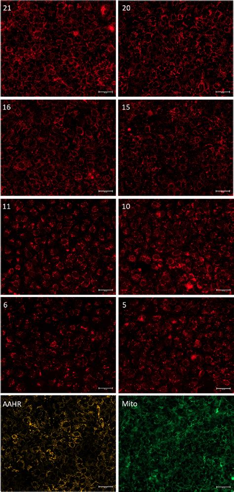 Analysis Of Subcellular Localization Of Cs2 Compounds Compared To The