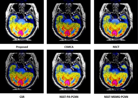 Output Images From Different Methods Performed On The Dataset S1