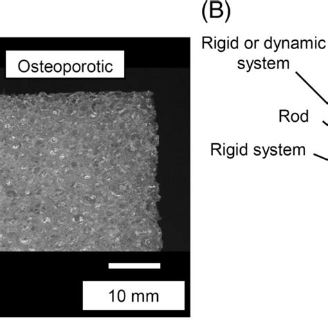 A Picture Of The Polyurethane Foam Blocks Replicating Healthy And