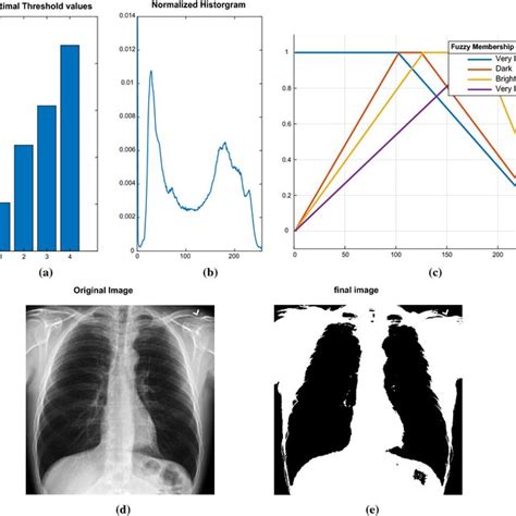Comparison Of Level Based Threshold Values And Histogram Of Input Chest