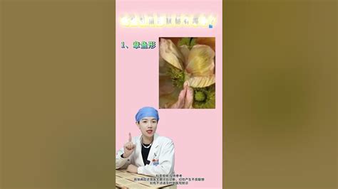 一起来了解一下吧！ 医学科普 女性 科普一下 抖出健康知识宝藏 Youtube