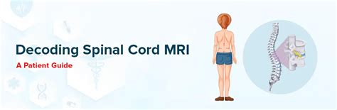 Decoding Spinal Cord Mri A Patient Guide Ganesh Diagnostic
