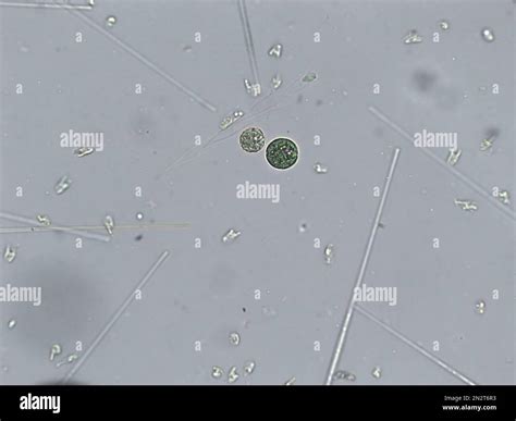Diatoms Algae Under Microscopic View Phytoplankton Fossils Silica