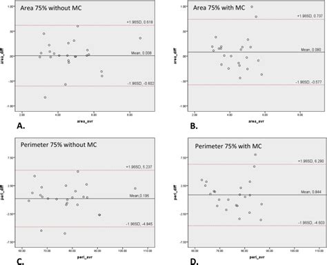 The Effect Of A Whole Heart Motion Correction Algorithm On Ct Image Quality And Measurement