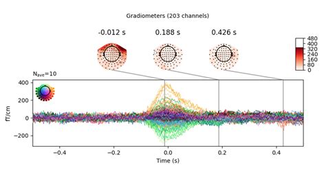 Overview Of Artifact Detection — Mne 1 3 1 Documentation