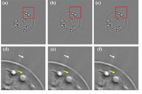 Figure 1 From Image Restoration For Ring Array Photoacoustic Tomography System Based On Blind
