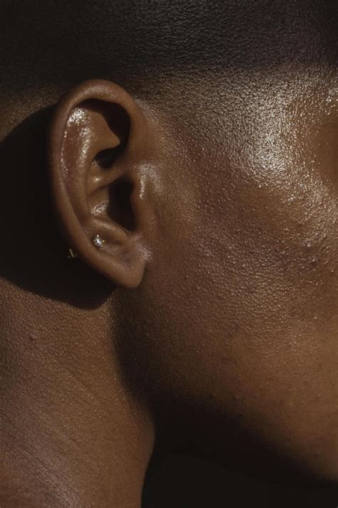 Do Keloid Scars On Ear Piercings Always Grow Treat Your Scars