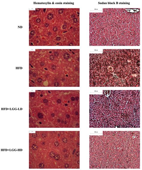 Effect Of Lactobacillus Rhamnosus Gg On Energy Metabolism Leptin