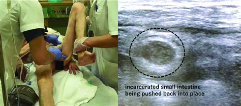 Step And Step The Surgeon Places The Transducer In The Left Hand Download Scientific