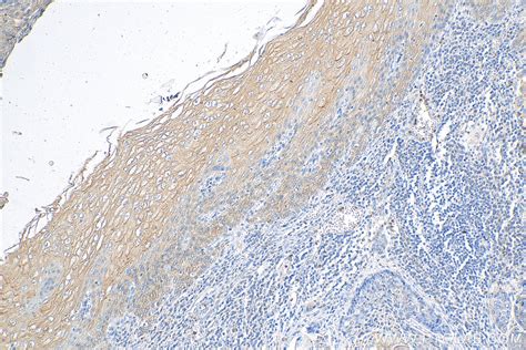 Cytokeratin 80 Antibody Biotin 16835 Proteintech