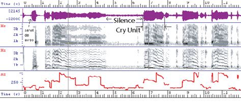 Figure 1 From Evolutionary Neural System To Classify Infant Cry Units For Pathologies